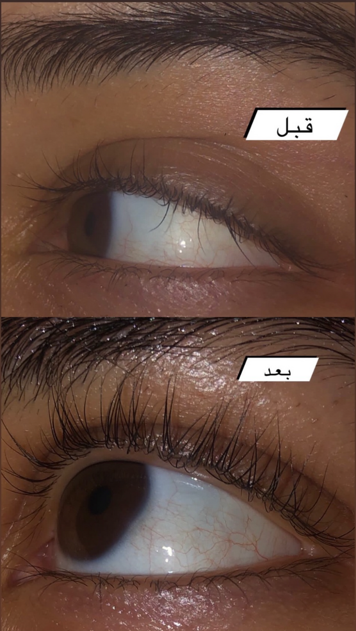 Eyelash Follicle Booster Gel | Raw African's Beauty Hub - Get the Raw ...
