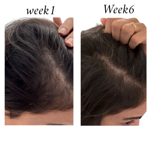 Shop Hair Growth | Raw African's Beauty Hub - Get the Raw Experience!